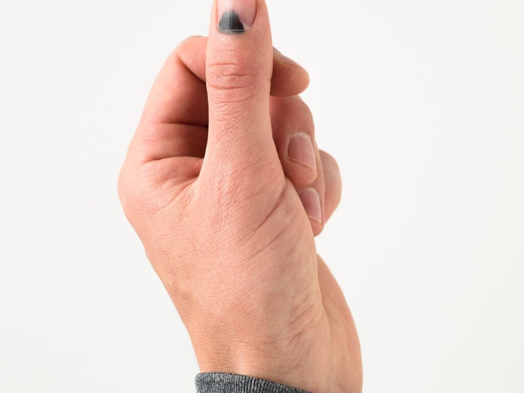 Nails Have Turned Black What To Do Medrot nails-have-turned-black-what-to-do-medrot